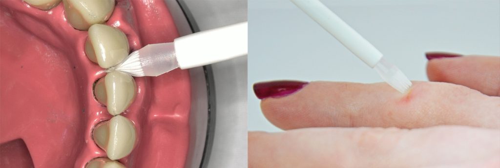 MICROBRISTLE APPLICATOR (MBA™) SYSTEMS FOR TOPICAL AND TRANSDERMAL DRUG ...