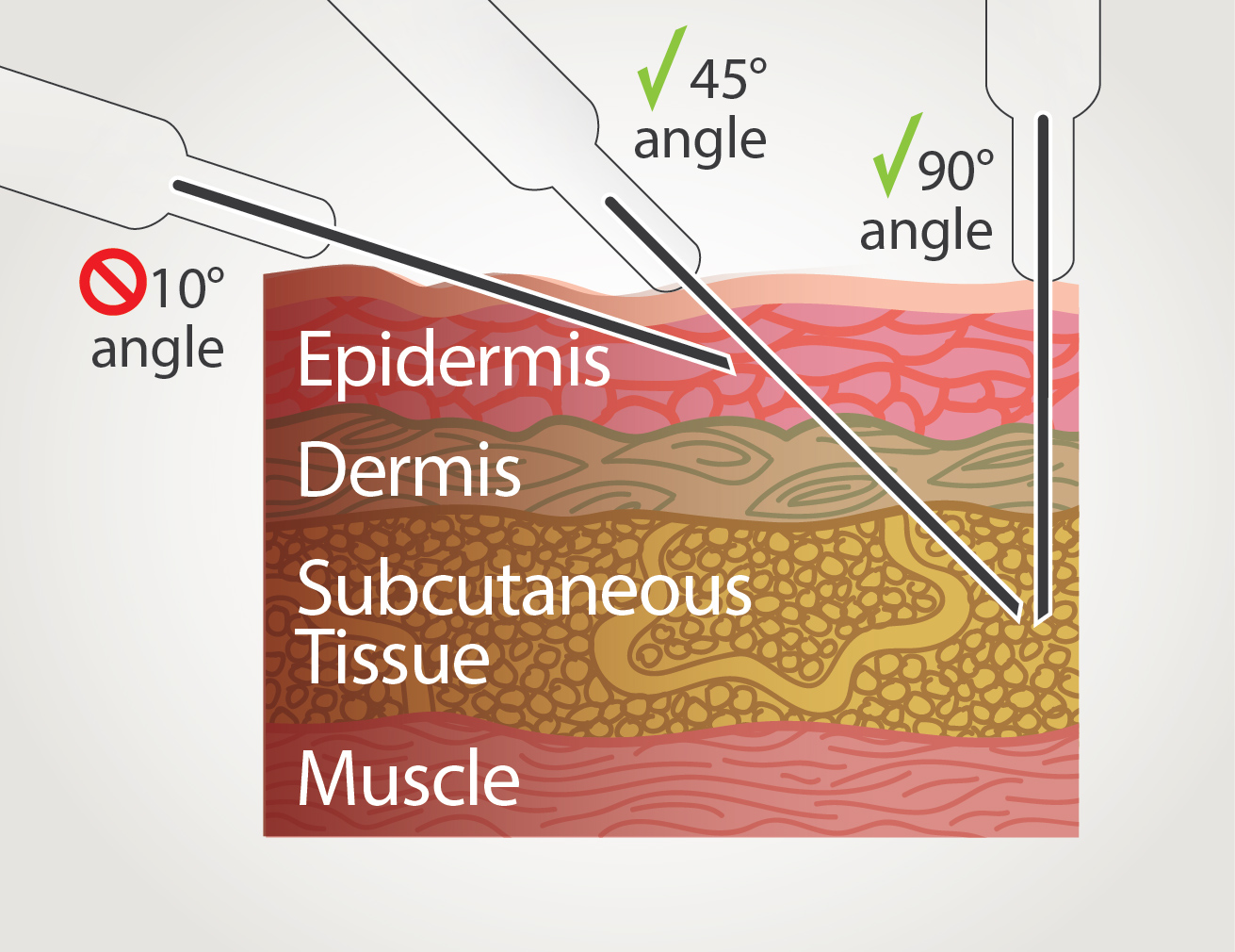 NOVEL APPROACHES INCREASE PATIENT CONFIDENCE & DECREASE ANXIETY ...