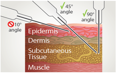 NOVEL APPROACHES & TECHNOLOGIES TO INCREASE PATIENT CONFIDENCE & DECREASE ANXIETY | ONdrugDelivery