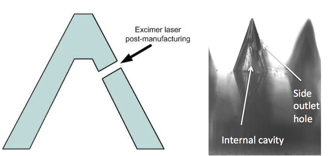 HIGHLY CUSTOMISABLE HOLLOW POLYMER MICRONEEDLE SOLUTIONS | ONdrugDelivery