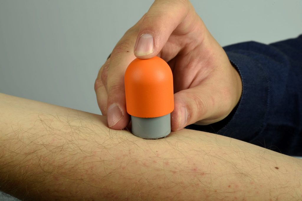 TERIPARATIDE MICRO-PATCH™: A SOLID MICRONEEDLE PRODUCT NEARING CLINICAL ...