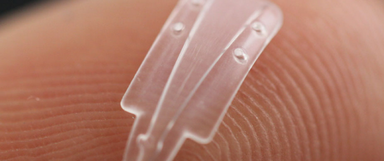 MICRO OPHTHALMIC OCULAR IMPLANTS - ONdrugDelivery