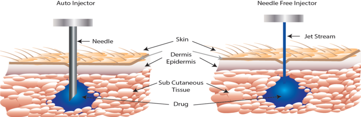 CONNECTED, NEEDLE-FREE DRUG DELIVERY - ONdrugDelivery