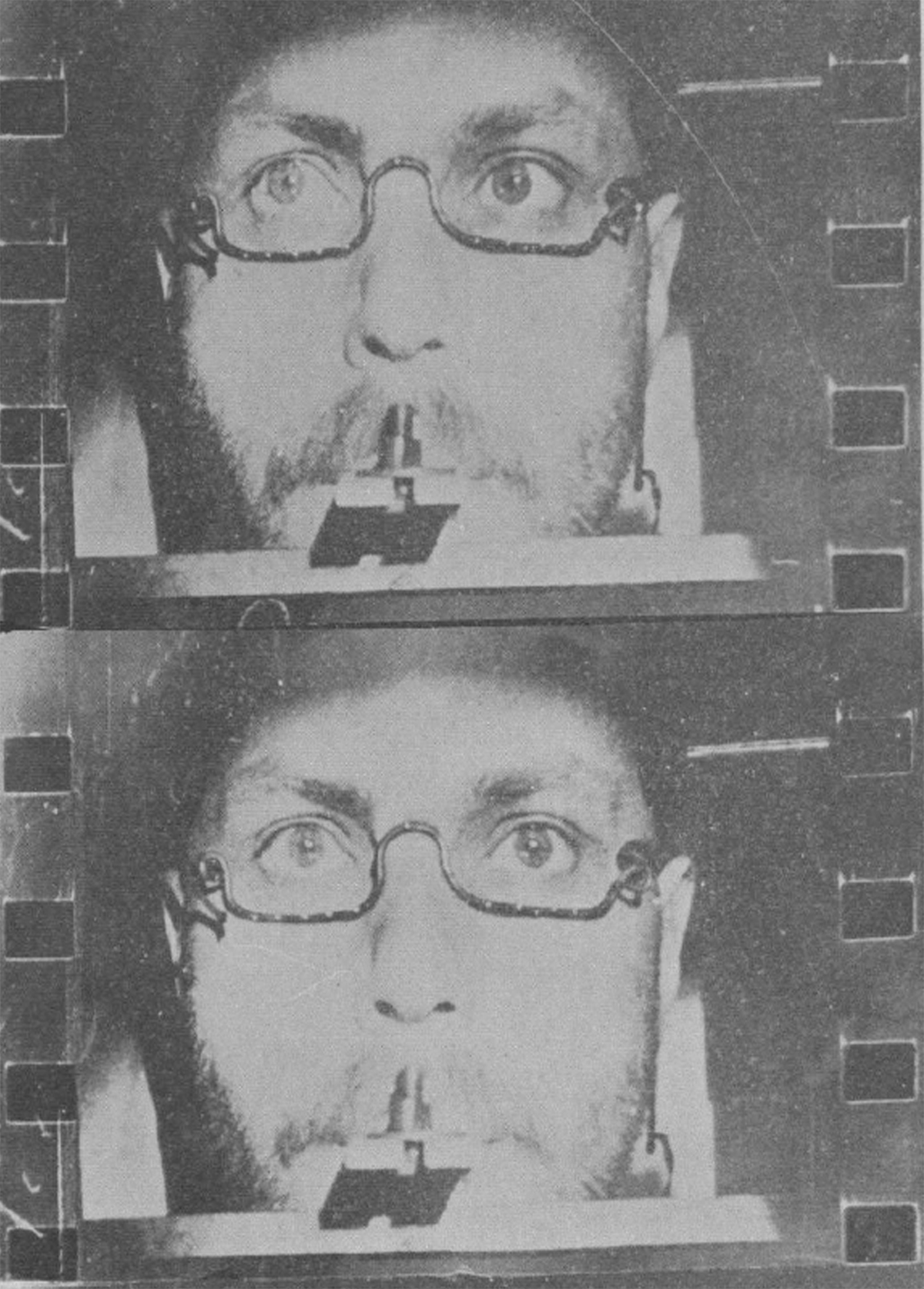 THE EYES HAVE IT – EYE TRACKING EVOLUTION IN MEDICAL DEVICE DEVELOPMENT ...