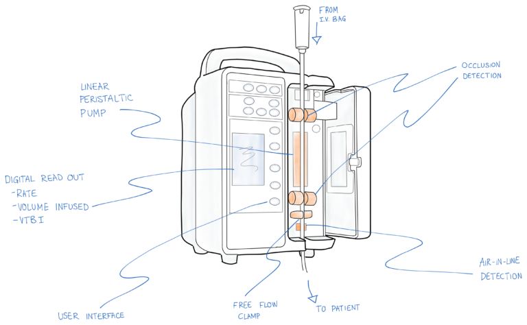 HOW SAFETY FEATURES MAKE OR BREAK INFUSION PUMP DESIGN - ONdrugDelivery