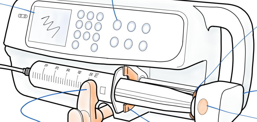 HOW SAFETY FEATURES MAKE OR BREAK INFUSION PUMP DESIGN - ONdrugDelivery