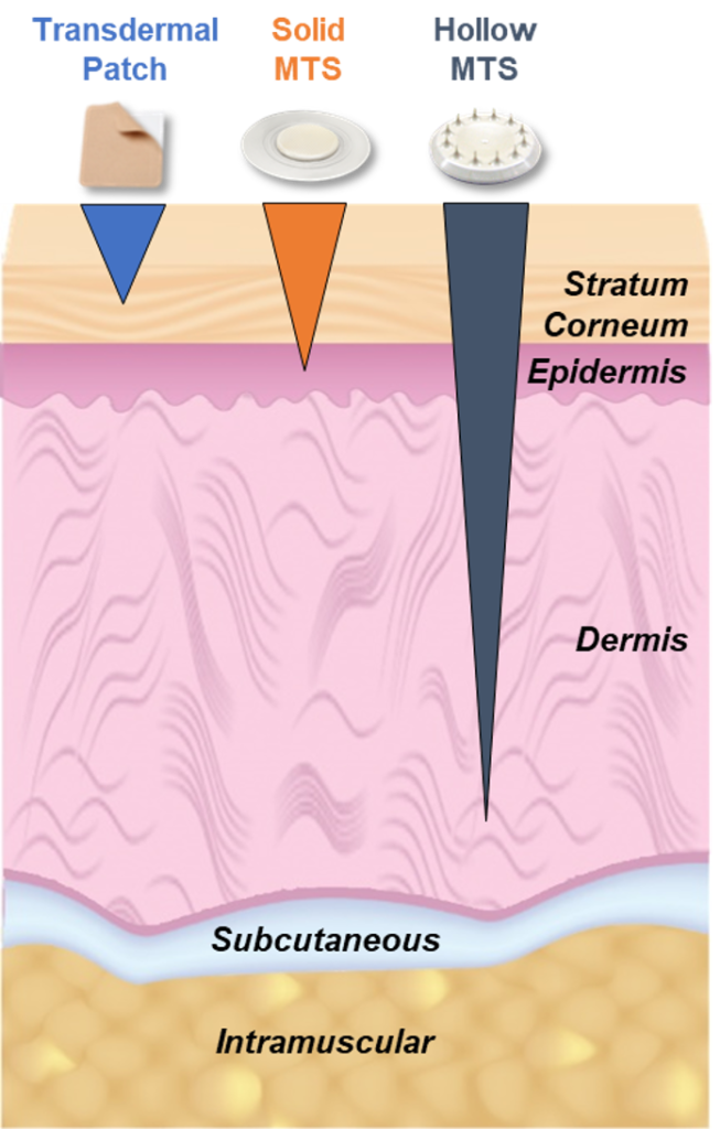 MICRONEEDLES FOR INTRADERMAL DELIVERY OF CANCER VACCINES | ONdrugDelivery