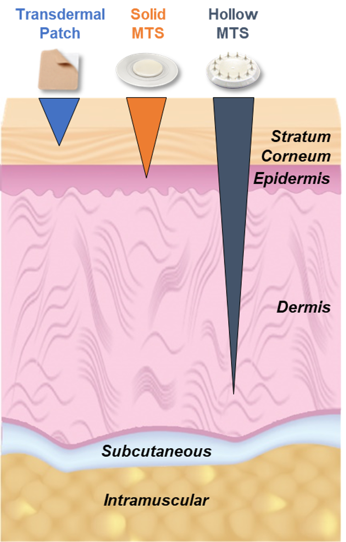 MICRONEEDLES FOR INTRADERMAL DELIVERY OF CANCER VACCINES | ONdrugDelivery