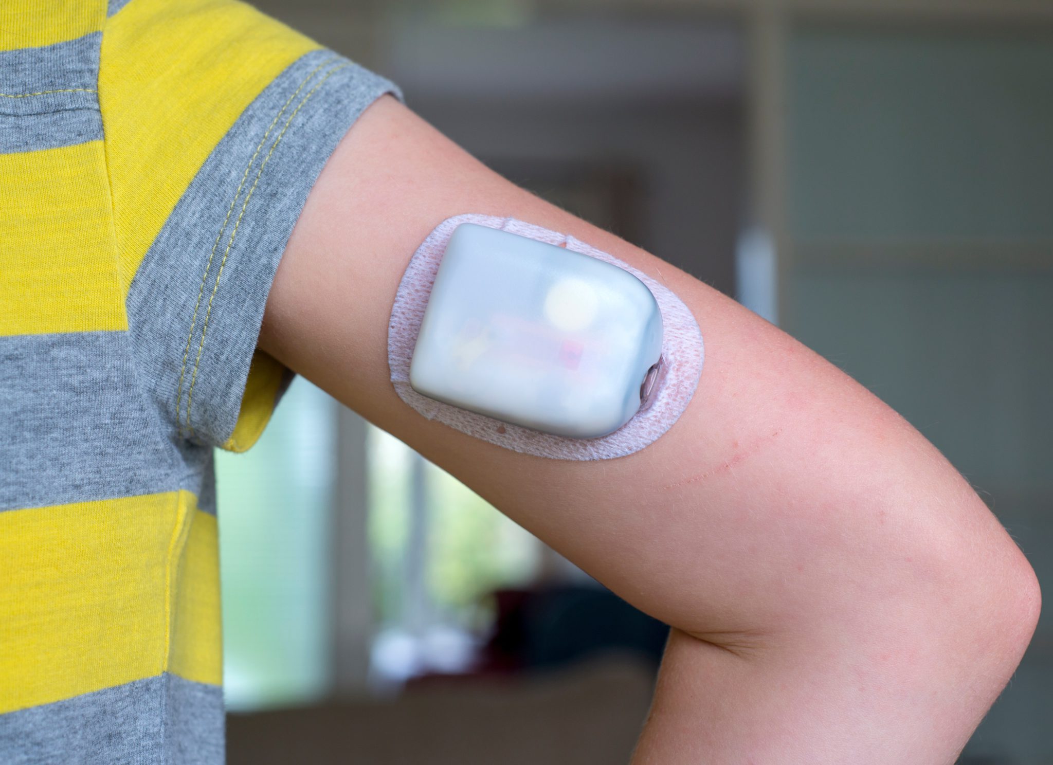 COMPLEXITY OF PATCH PUMP ASSEMBLY AND CONSIDERATIONS FOR MASTERING IT ...