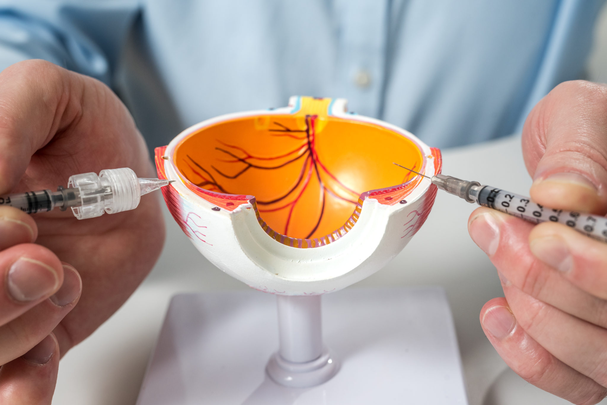 A NEW PLATFORM FOR SUPRACHOROIDAL DRUG DELIVERY USING STANDARD NEEDLES ...