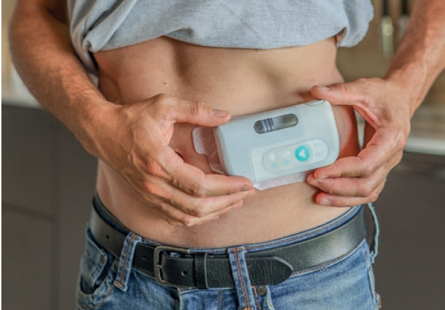 OFFERING A SMART AND SUSTAINABLE ON-BODY INJECTOR FOR CHRONICALLY ILL ...