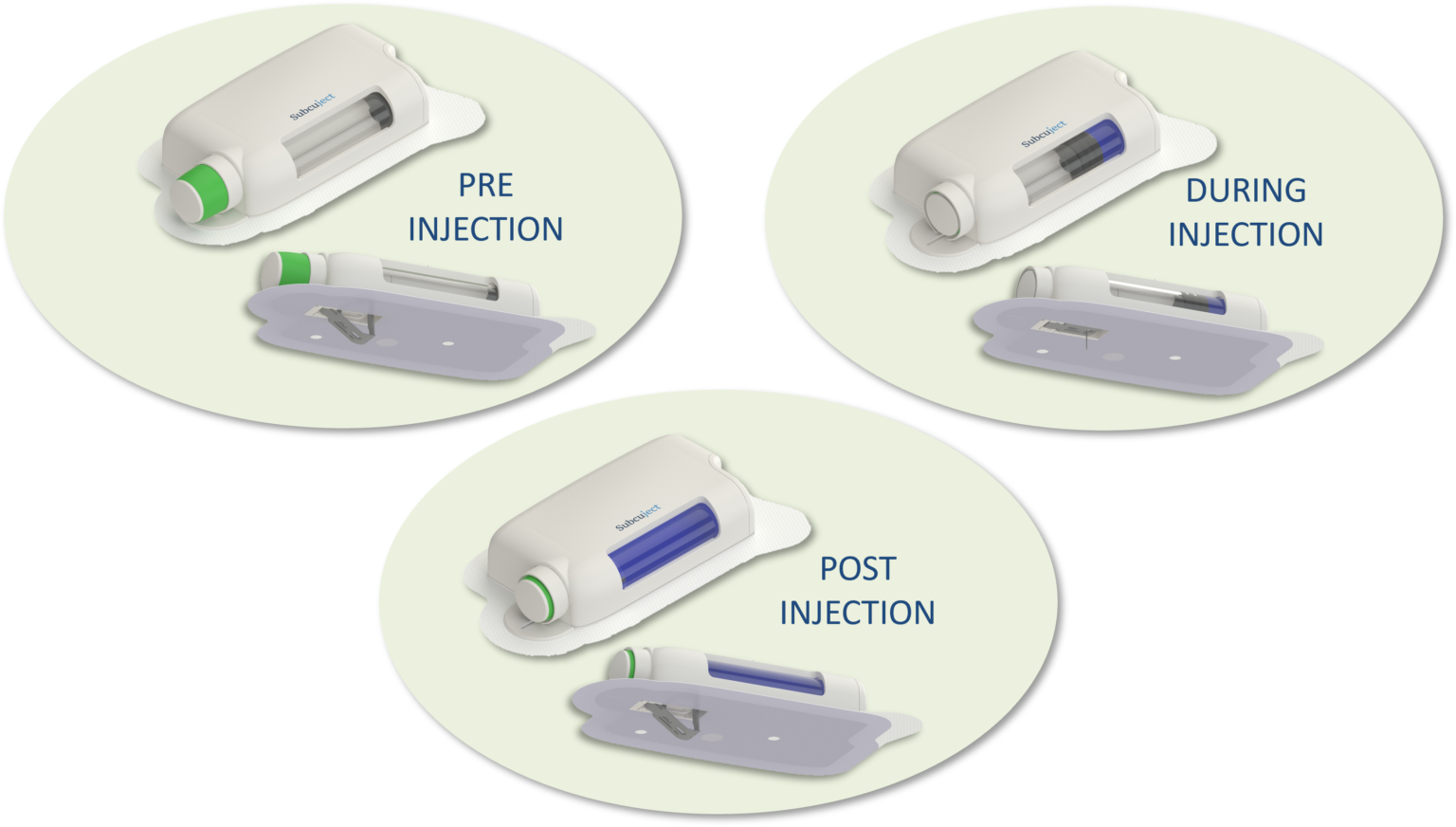 LOW-COMPLEXITY, EASY-TO-USE WEARABLE INJECTION PLATFORM | ONdrugDelivery