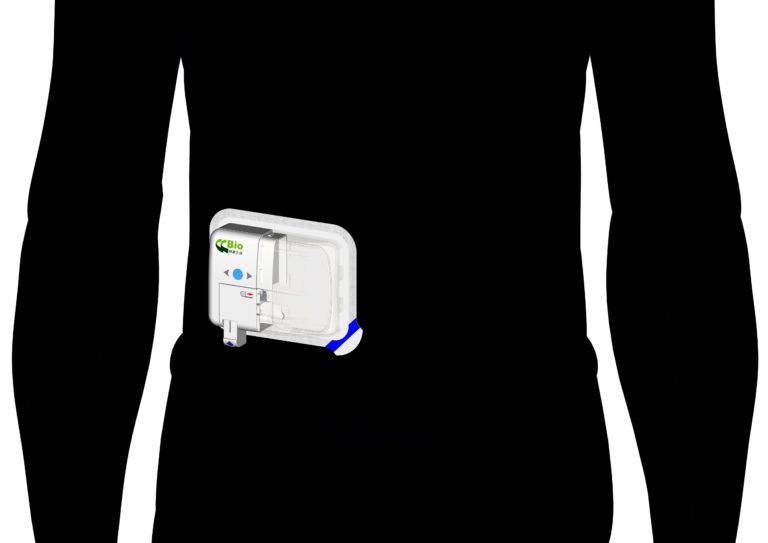 Technology Showcase: CCBio’s Felice Dose – Simplifying Subcutaneous ...