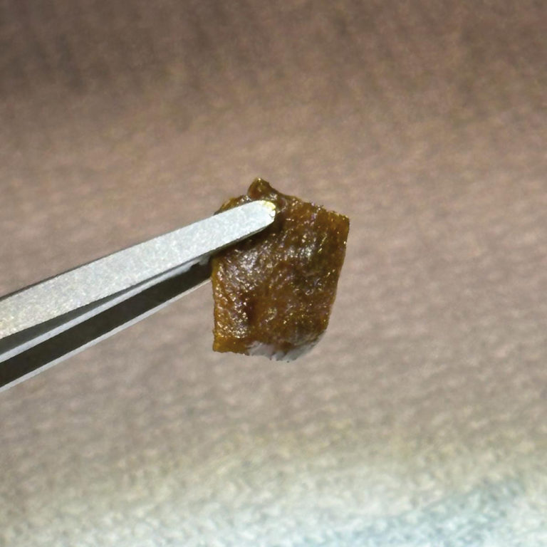 TACKLING IRON-DEFICIENCY ANAEMIA: A LEAP FORWARD WITH A REVOLUTIONARY ...