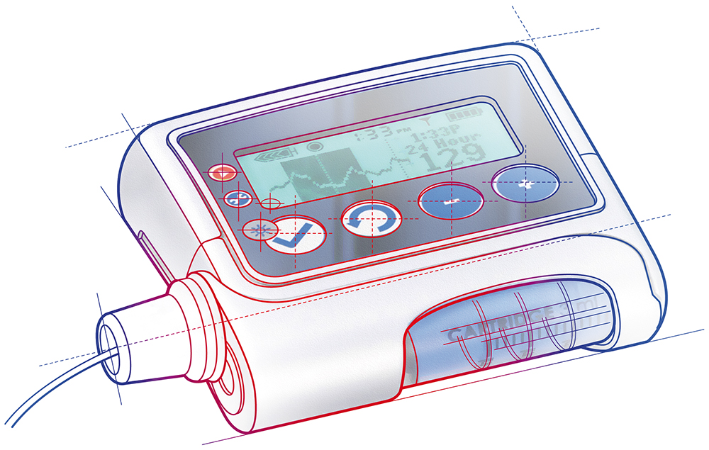 MATERIAL SELECTION & EFFICIENT DEVELOPMENT PROCESSES FOR WEARABLE ...